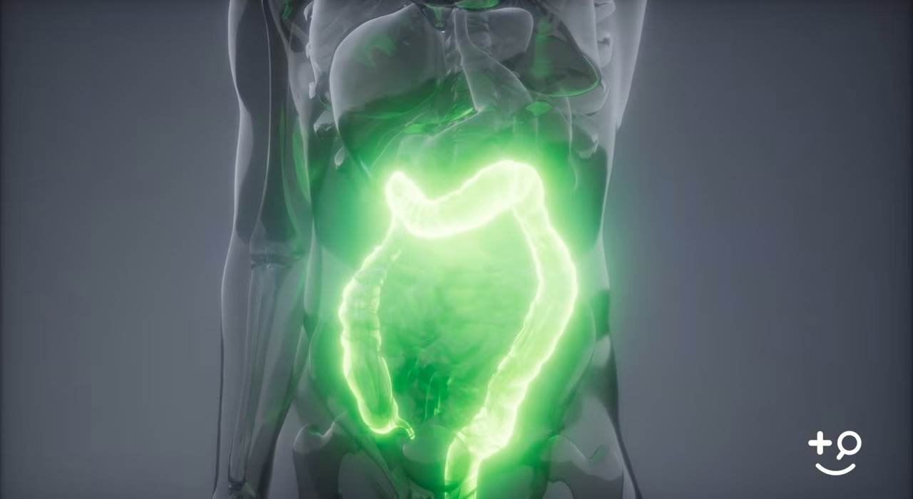 Colon Cancer - Appendiceal Cancer - Doctorpedia Doctor-Reviewed Video