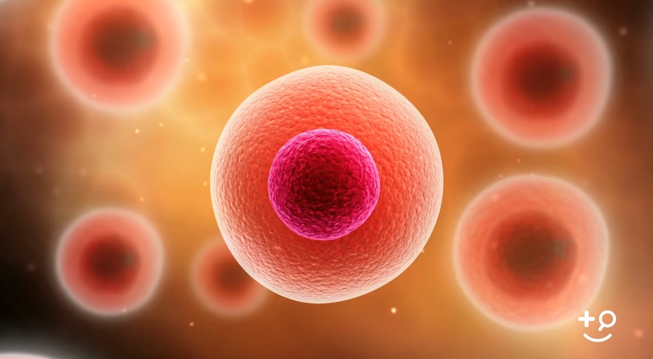 Glioblastoma - Causes - Doctorpedia Doctor-Reviewed Video