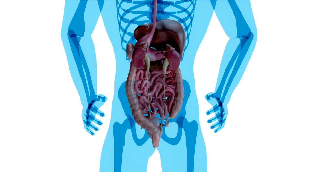 Colon Cancer - Stage 4 Reasons For Surgery - Doctorpedia Doctor ...