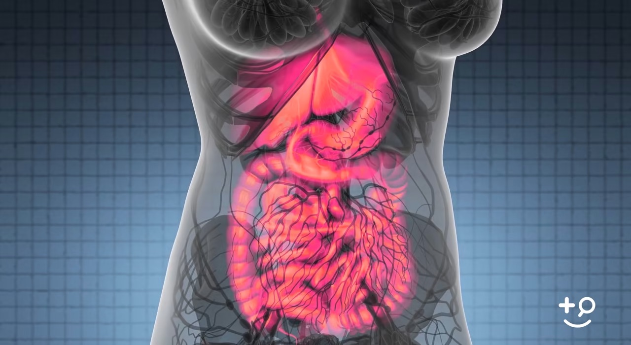 Gastroparesis - Overview - Doctorpedia Doctor-Reviewed Video