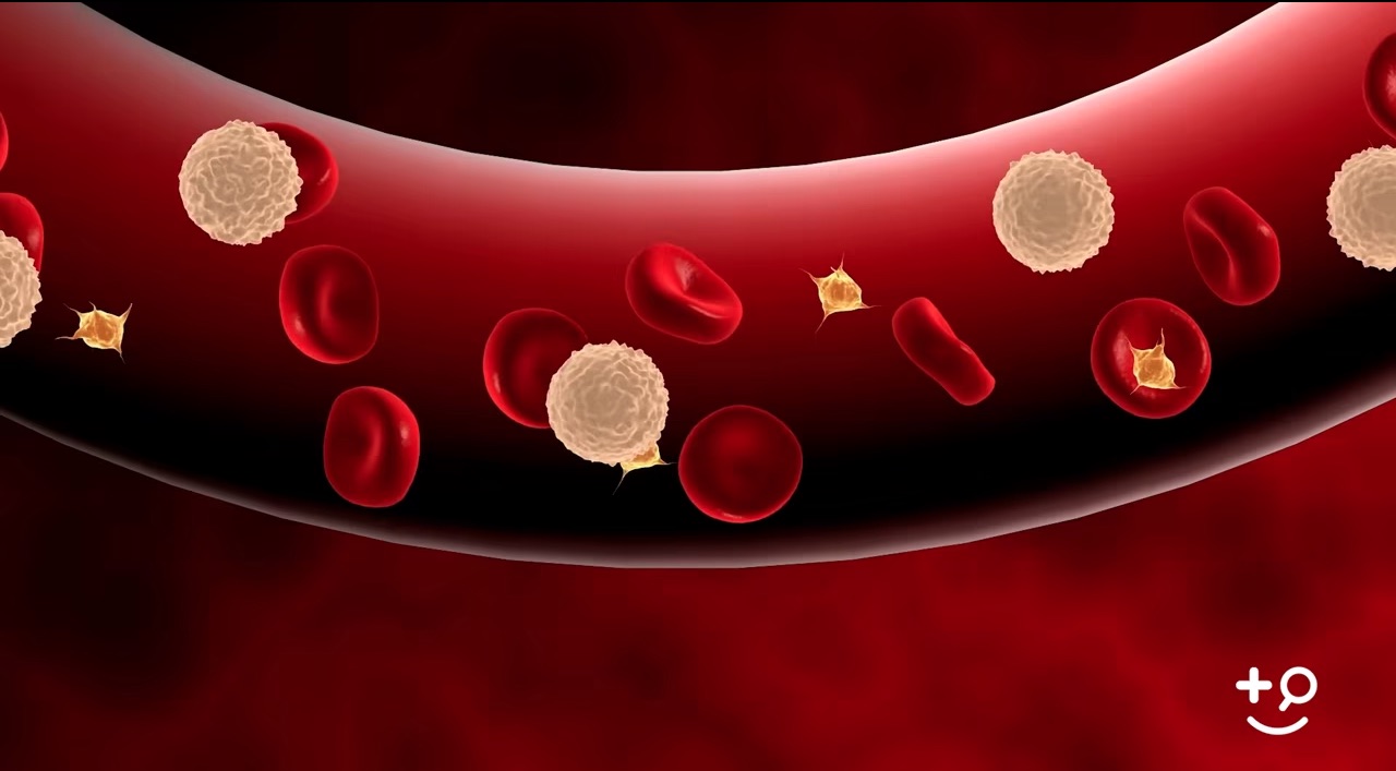 Vasculitis Overview Doctorpedia Doctor Reviewed Video