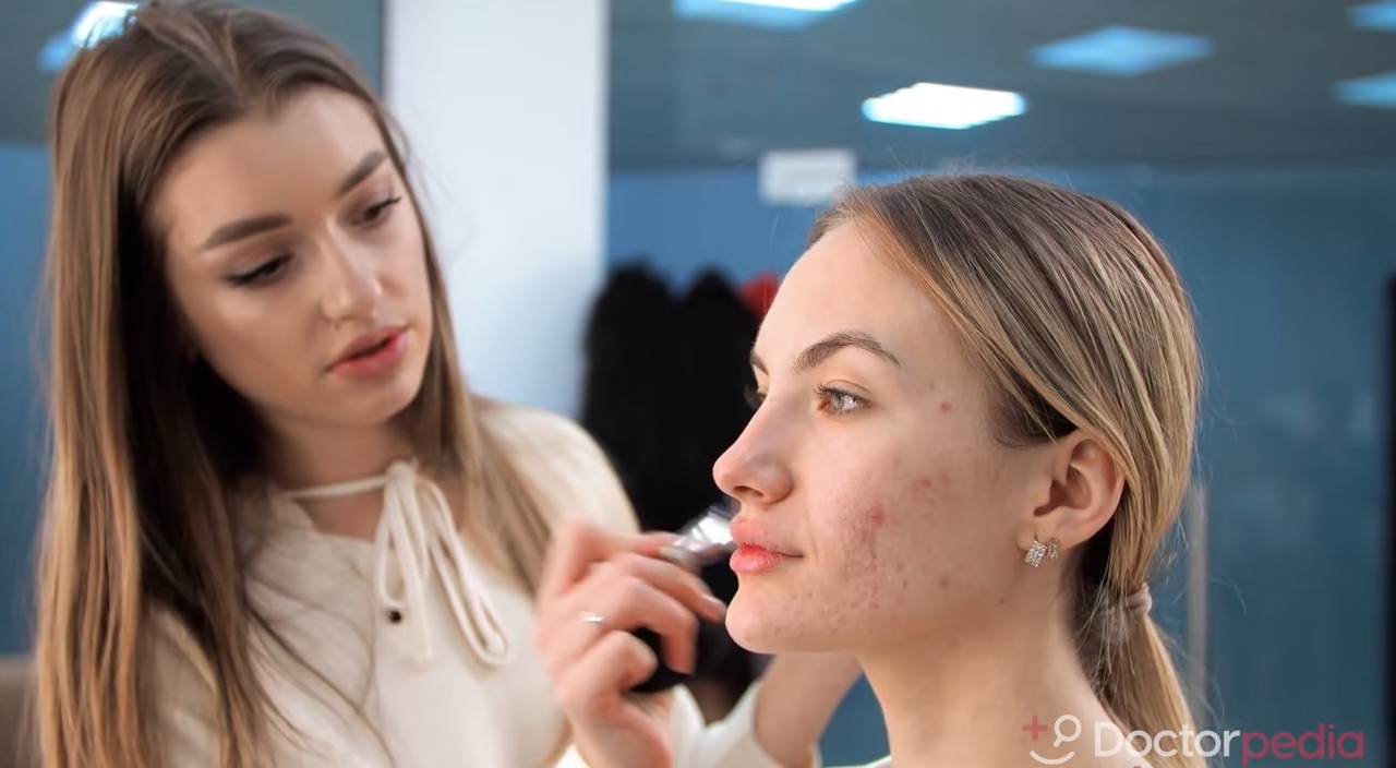 Acne - Risk Factors - Doctorpedia Doctor-Reviewed Video