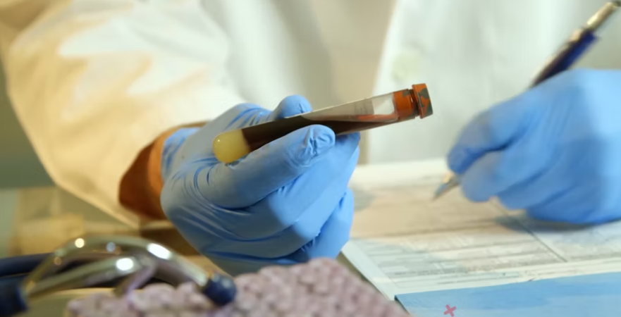 Lung Cancer - Pulmonary Embolism Diagnosis - Doctorpedia