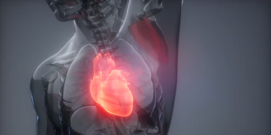 Lung Cancer - Pulmonary Embolism - Doctorpedia